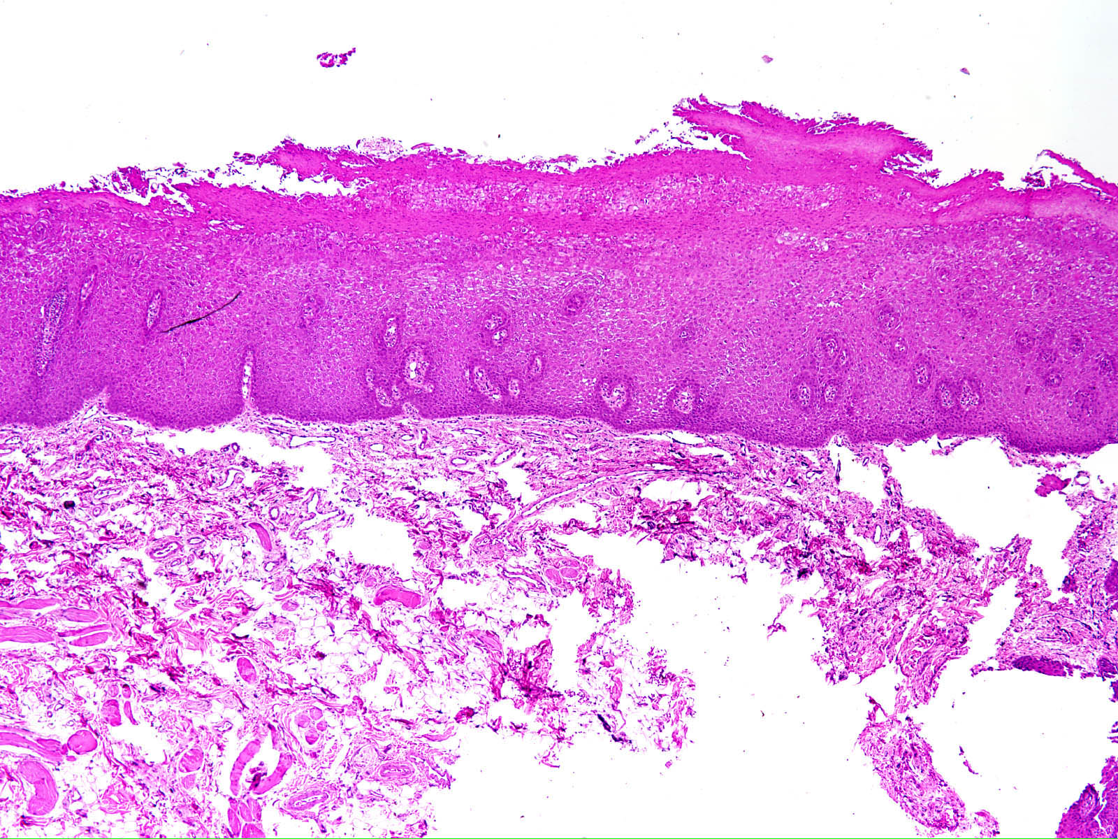 WSN-A. H&E, lower magnification